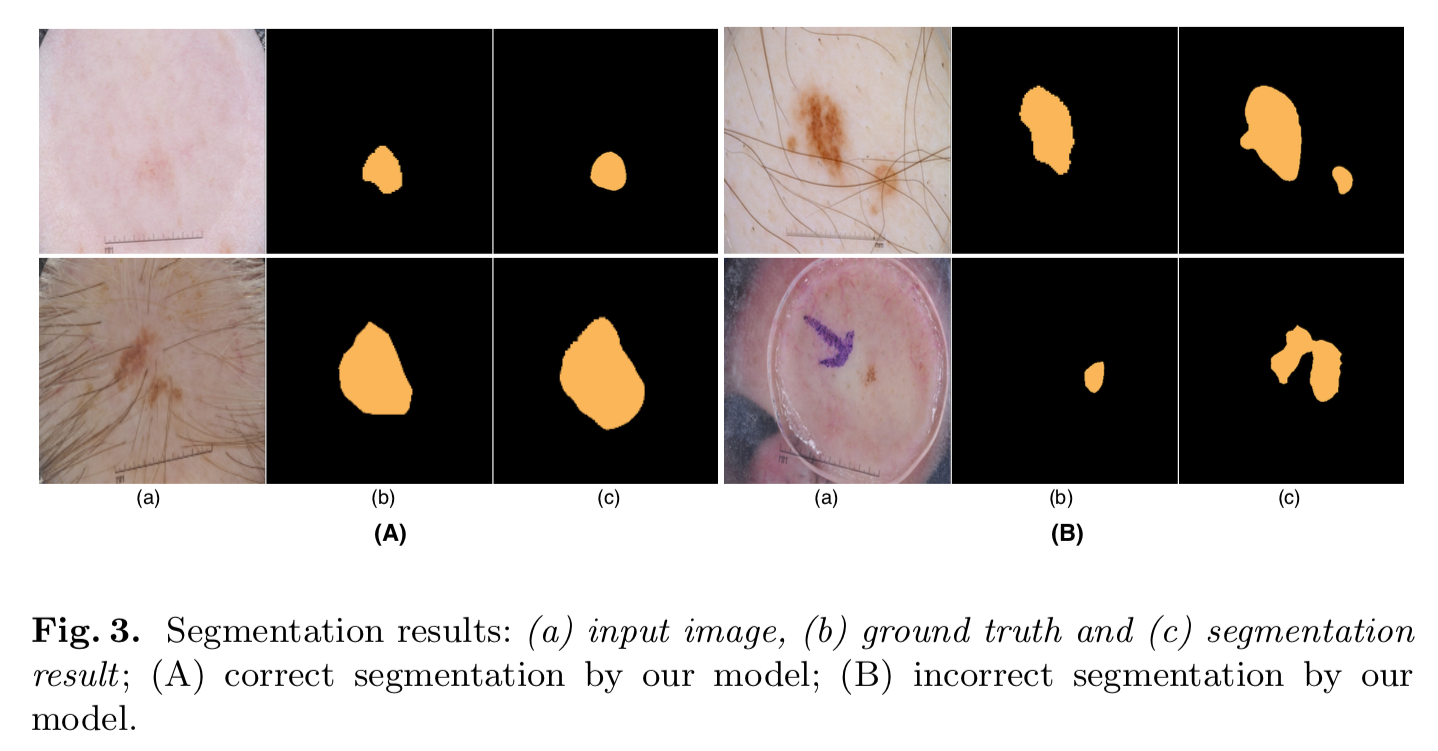 Github Andrewsopokuskin Lesion Segmentation Skin Lesi